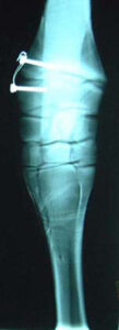 Angular Limb Deviation in Horses - American College of Veterinary Surgeons