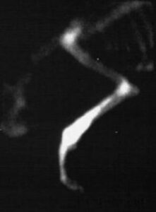 Bone Tumors in Cats and Dogs - American College of Veterinary Surgeons
