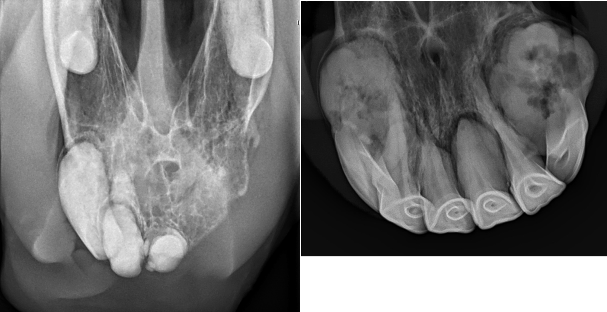 Equine Odontoclastic Tooth Resorption and Hypercementosis (EOTRH)